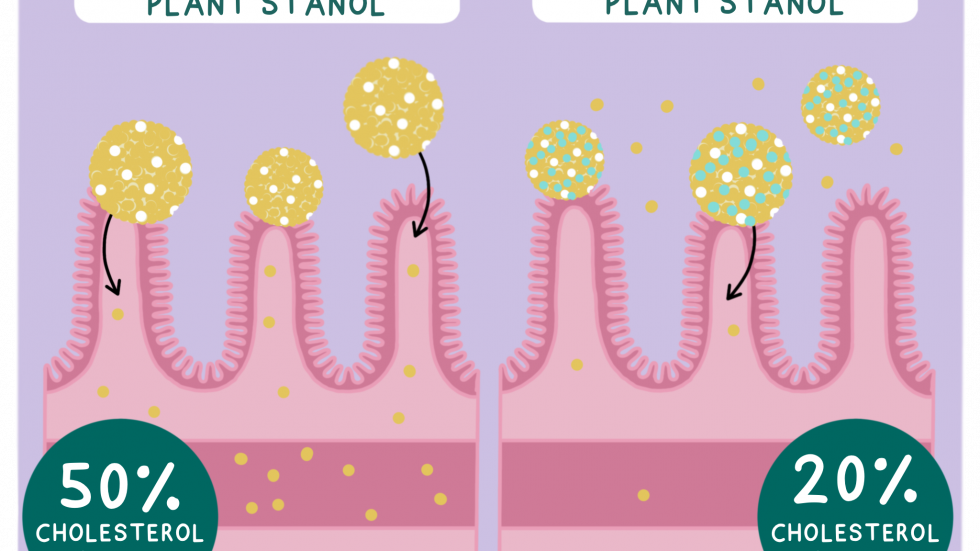 How plant stanols and sterols work to lower cholesterol